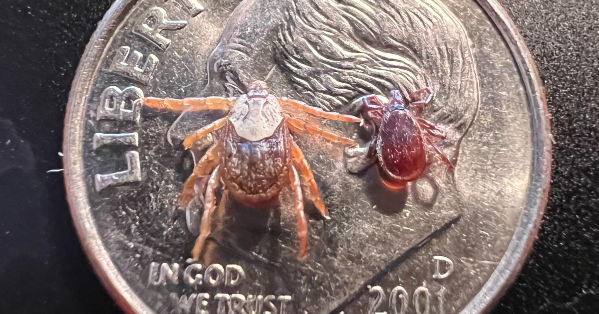 Federal NIH Cuts Hit Greater Yellowstone Disease Research